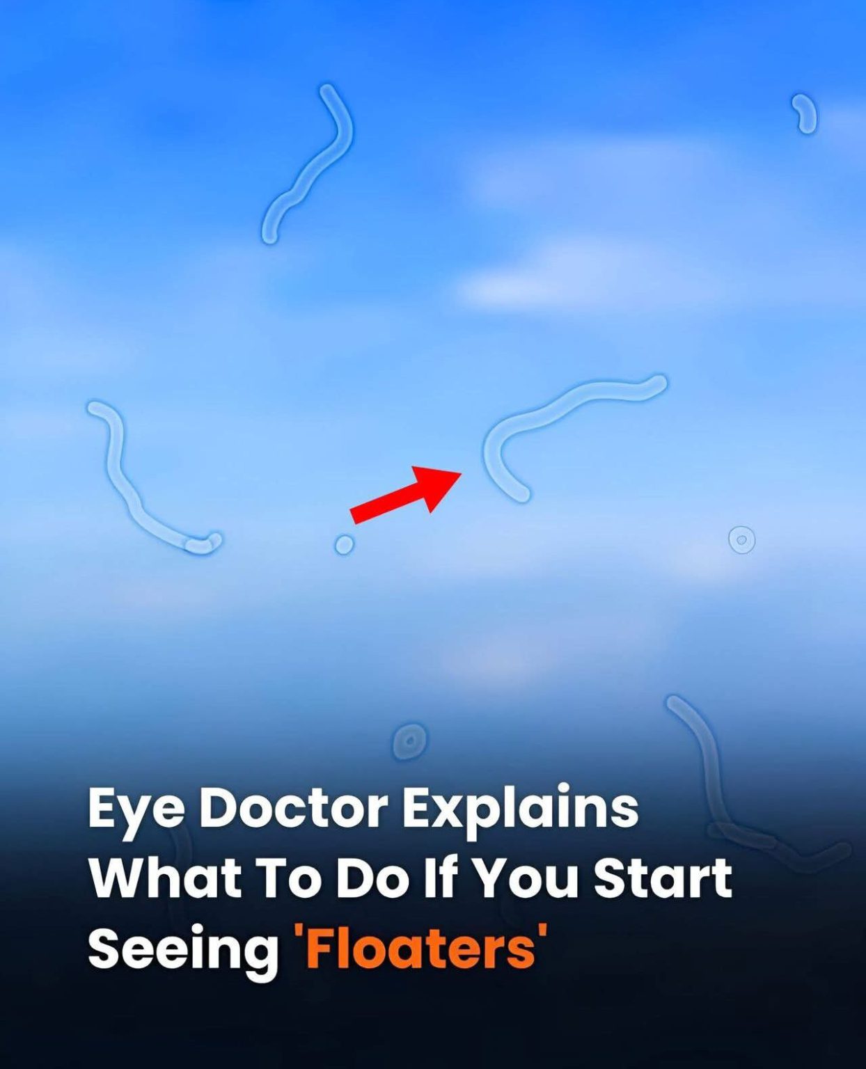 What Are Eye Floaters Here What To Do If You Start Seeing Them
